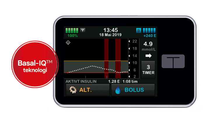Basal-IQ teknologi | Rubin Medical